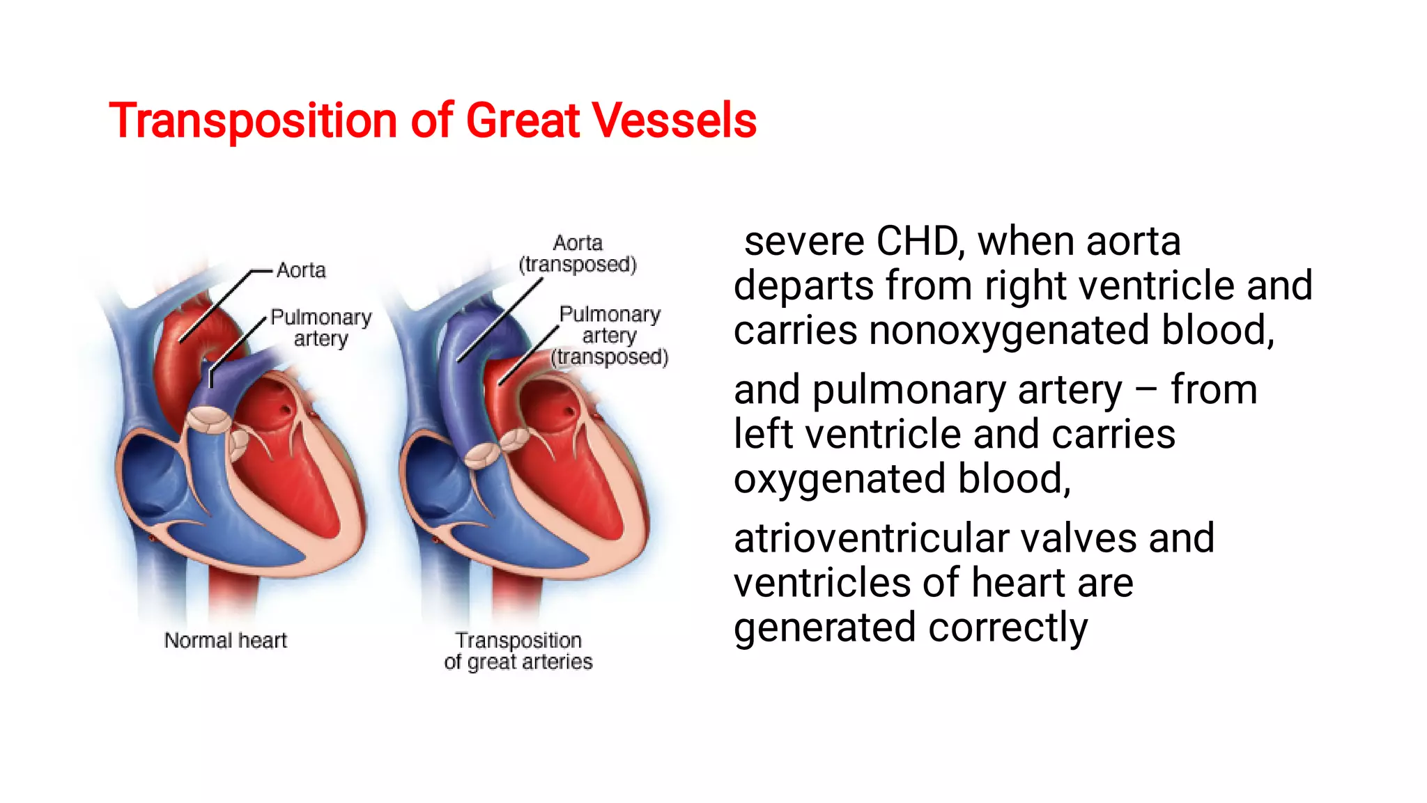 Cardiovascular System (pediatrics) | PDF