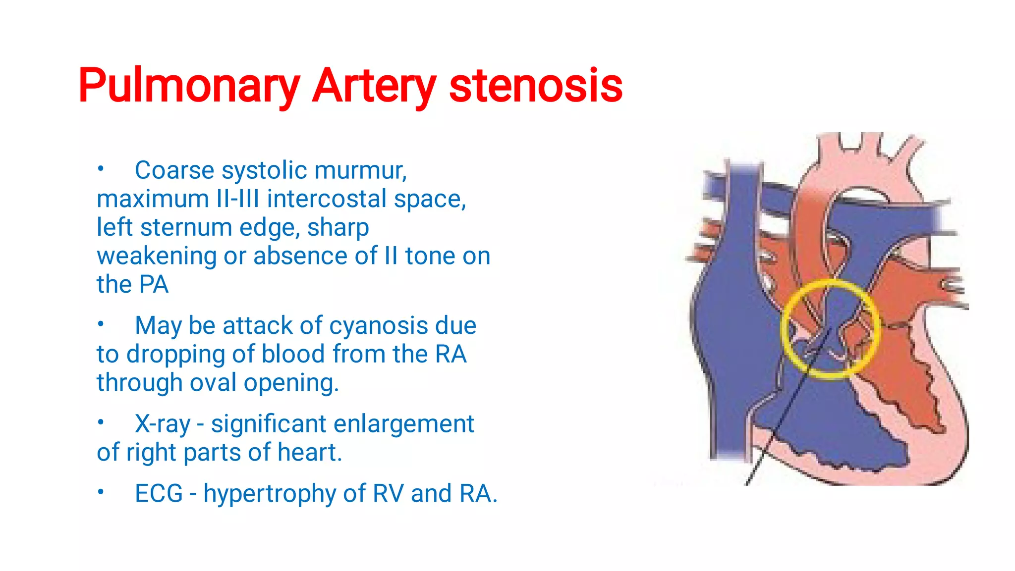 Cardiovascular System (pediatrics) | PDF