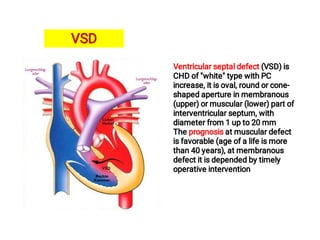 Cardiovascular System (pediatrics) | PDF