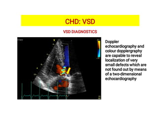 Cardiovascular System (pediatrics) | PDF