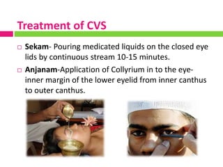 Computer vision syndrome. | PPT