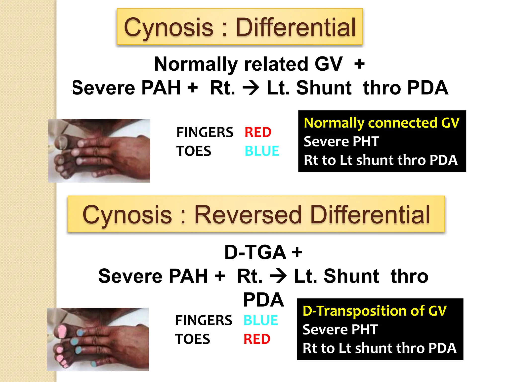 Approach to Pediatric Cardiovascular diseases.pptx