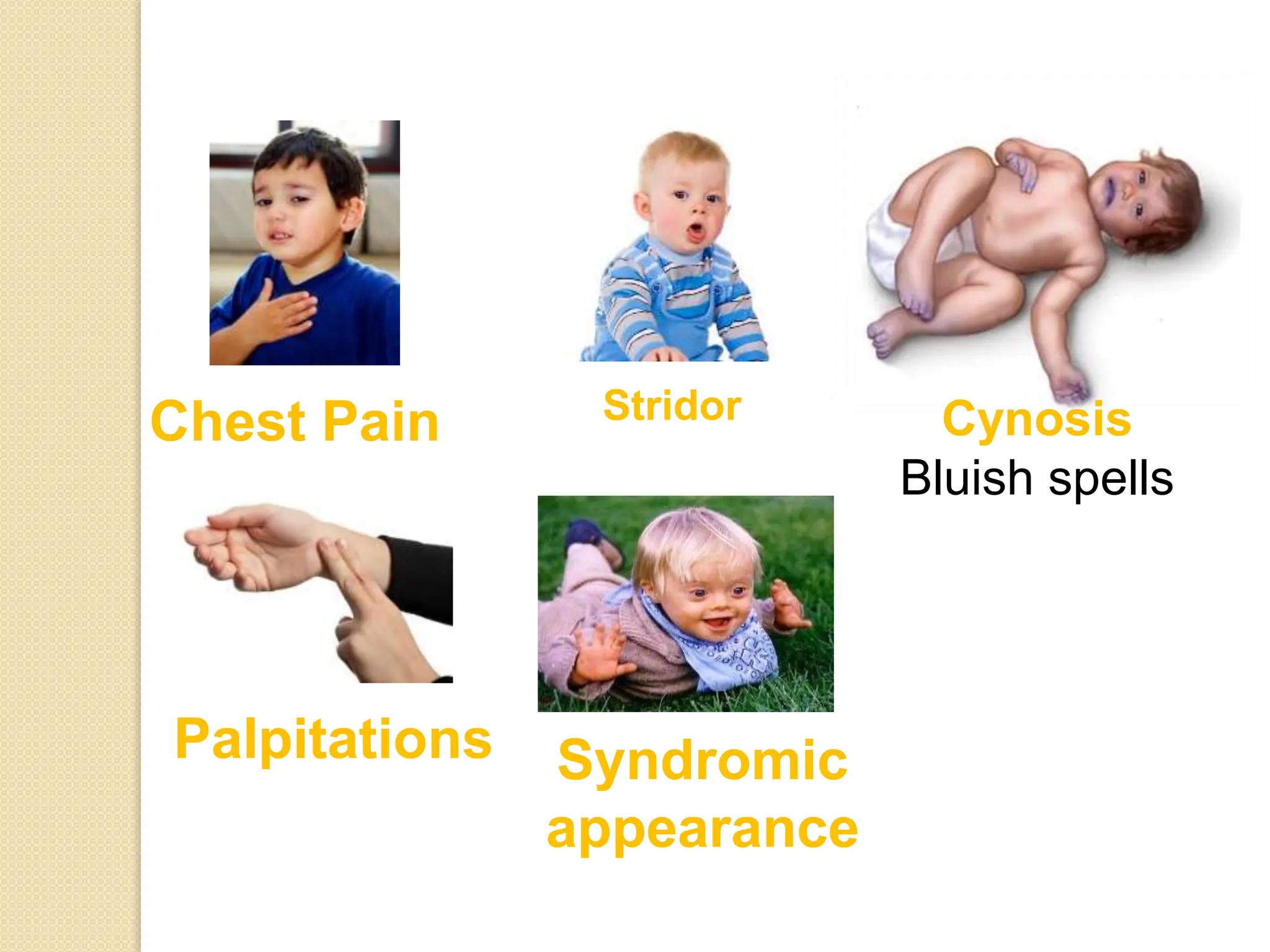 Approach to Pediatric Cardiovascular diseases.pptx