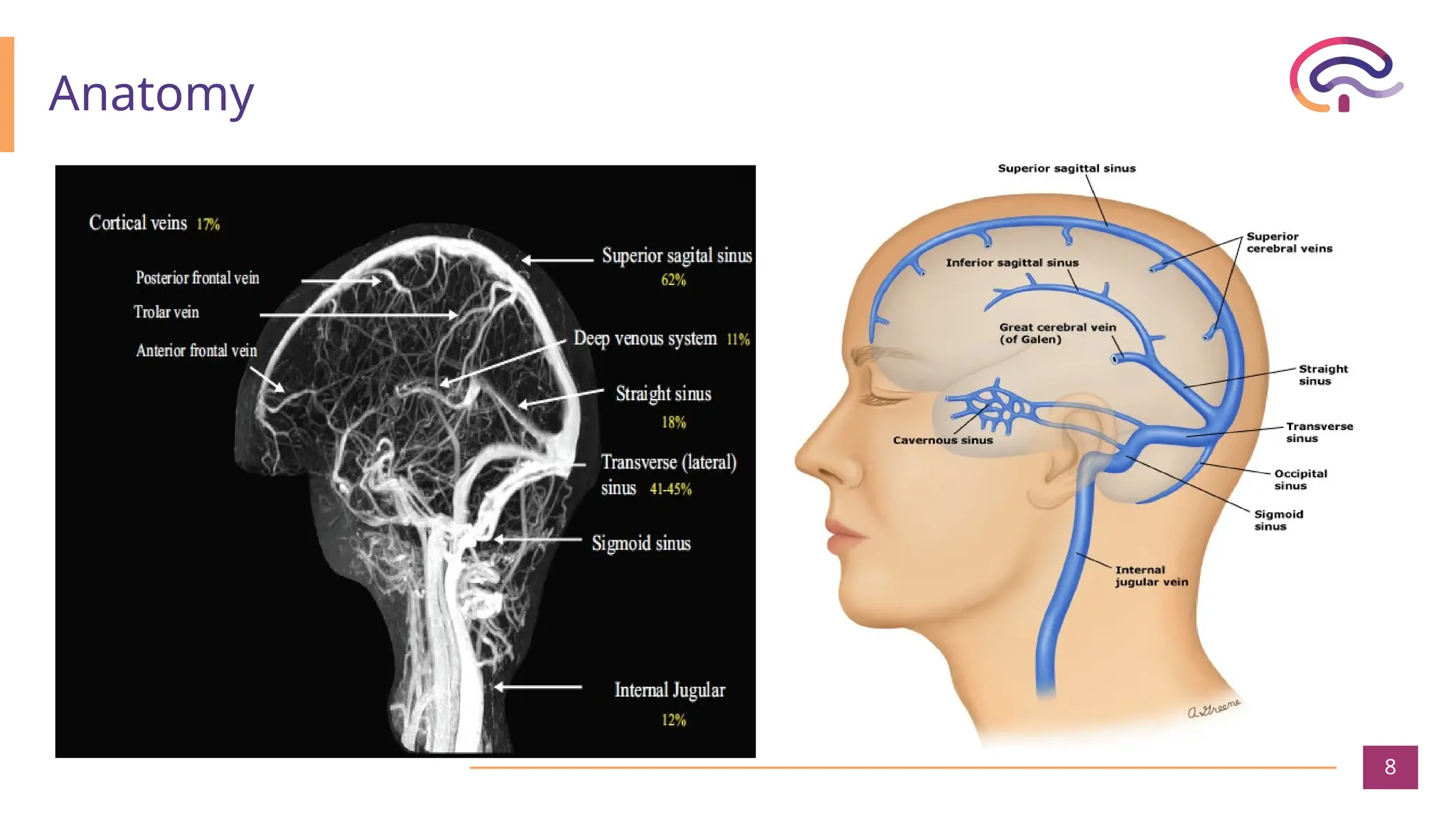 Cerebral venous sinus thrombosis : Clinical picture and management | PPTX