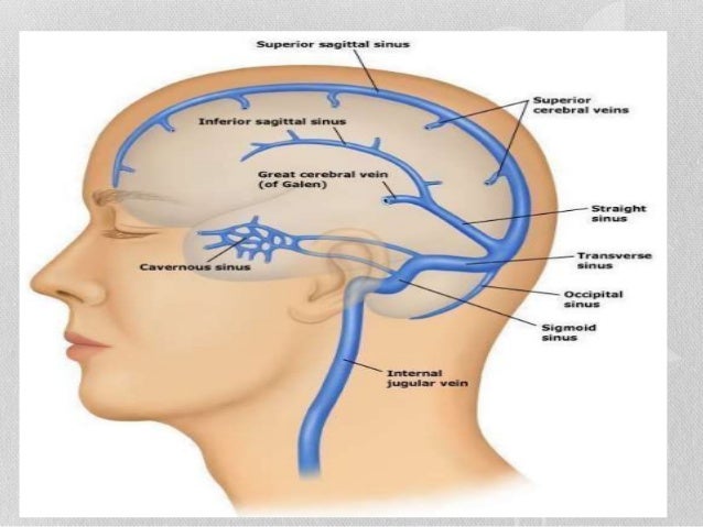 CEREBRAL VENOUS THROMBOSIS
