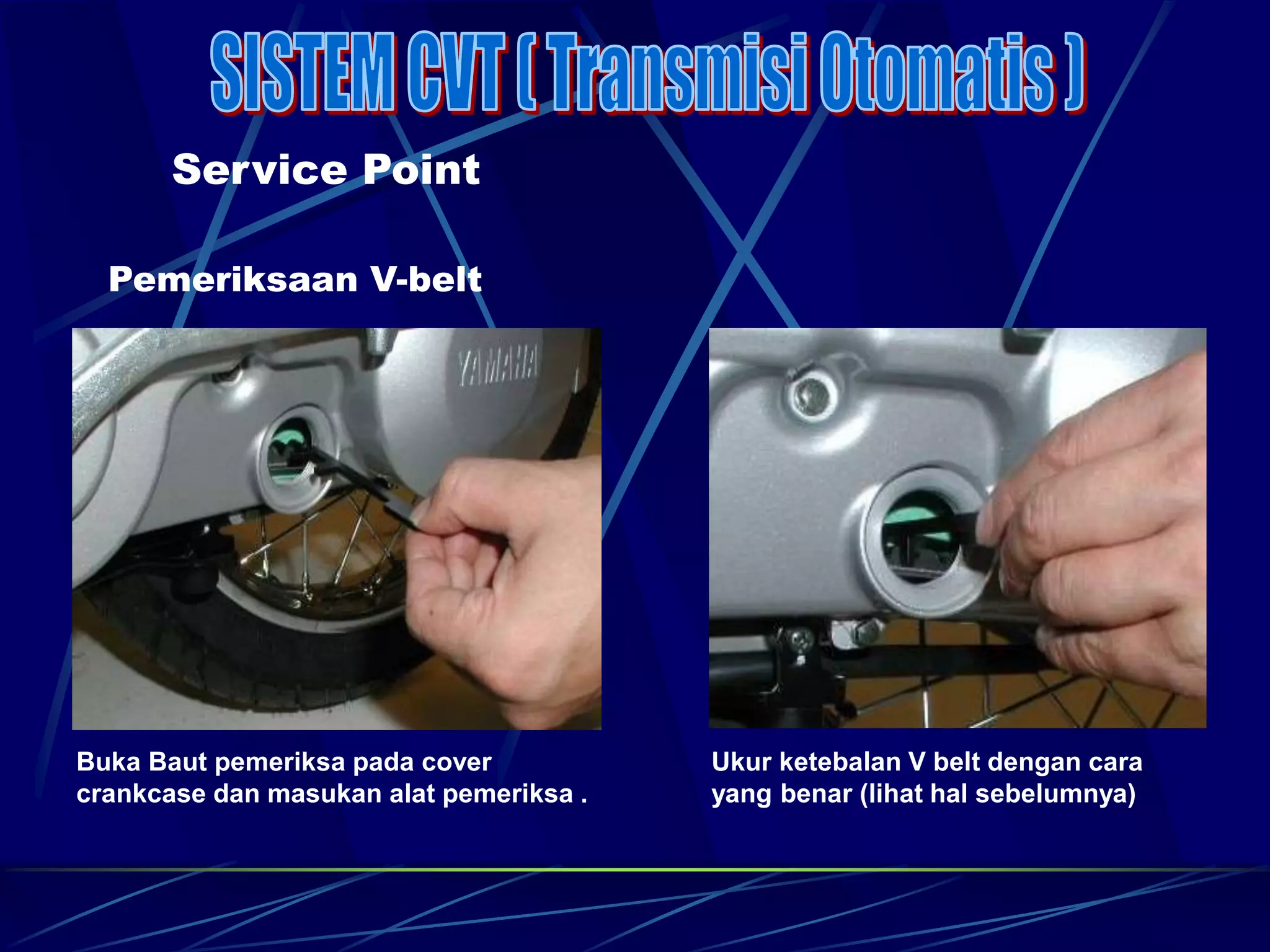 Cvt | PPT