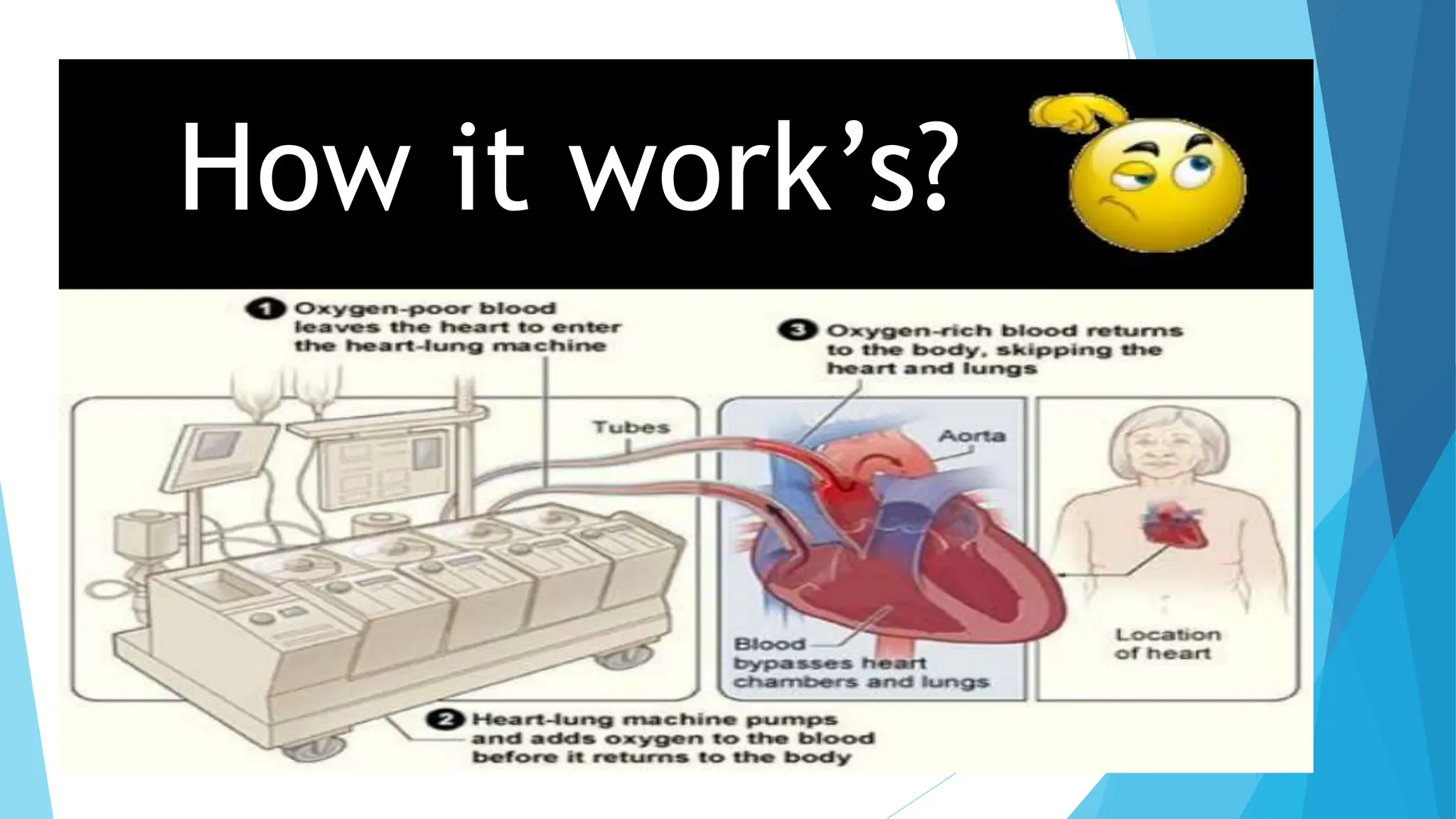 Basic Principle of Cardiopulmonary Bypass (CPB).pptx