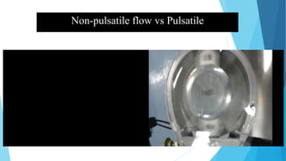 Basic Principle of Cardiopulmonary Bypass (CPB).pptx