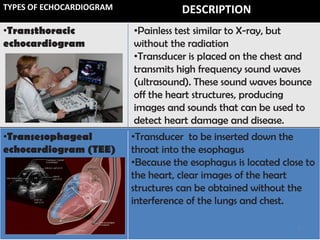 Cardiovascular testing 2 | PPT