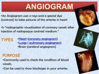 Cardiovascular testing 2 | PPT