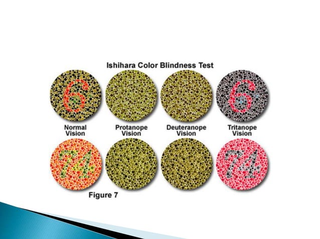 Colour vision test | PPTX | Eye and Vision Conditions | Diseases and ...