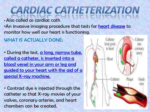 Cardiovascular testing 1