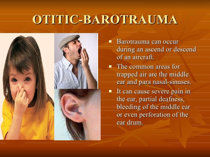 Barotrauma ear bombing - Flexjo