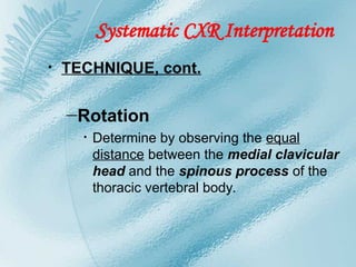 Chest X-Ray Interpretation of the human body | PPT