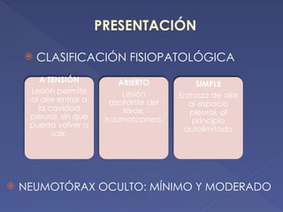 Comprehensive Overview of Pneumothorax: Diagnosis, Classification, and ...