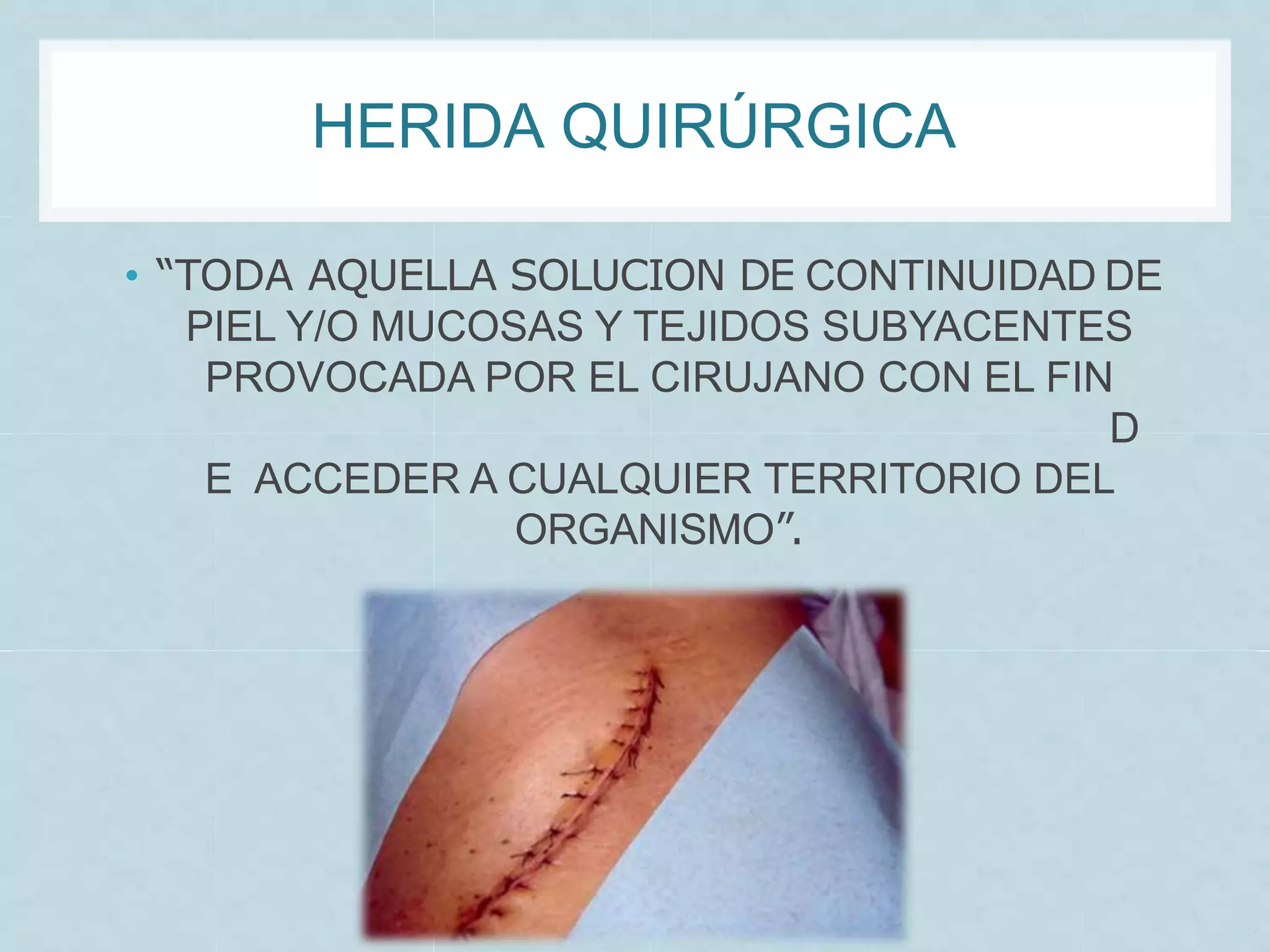 INFECCION HERIDA QUIRURGICA