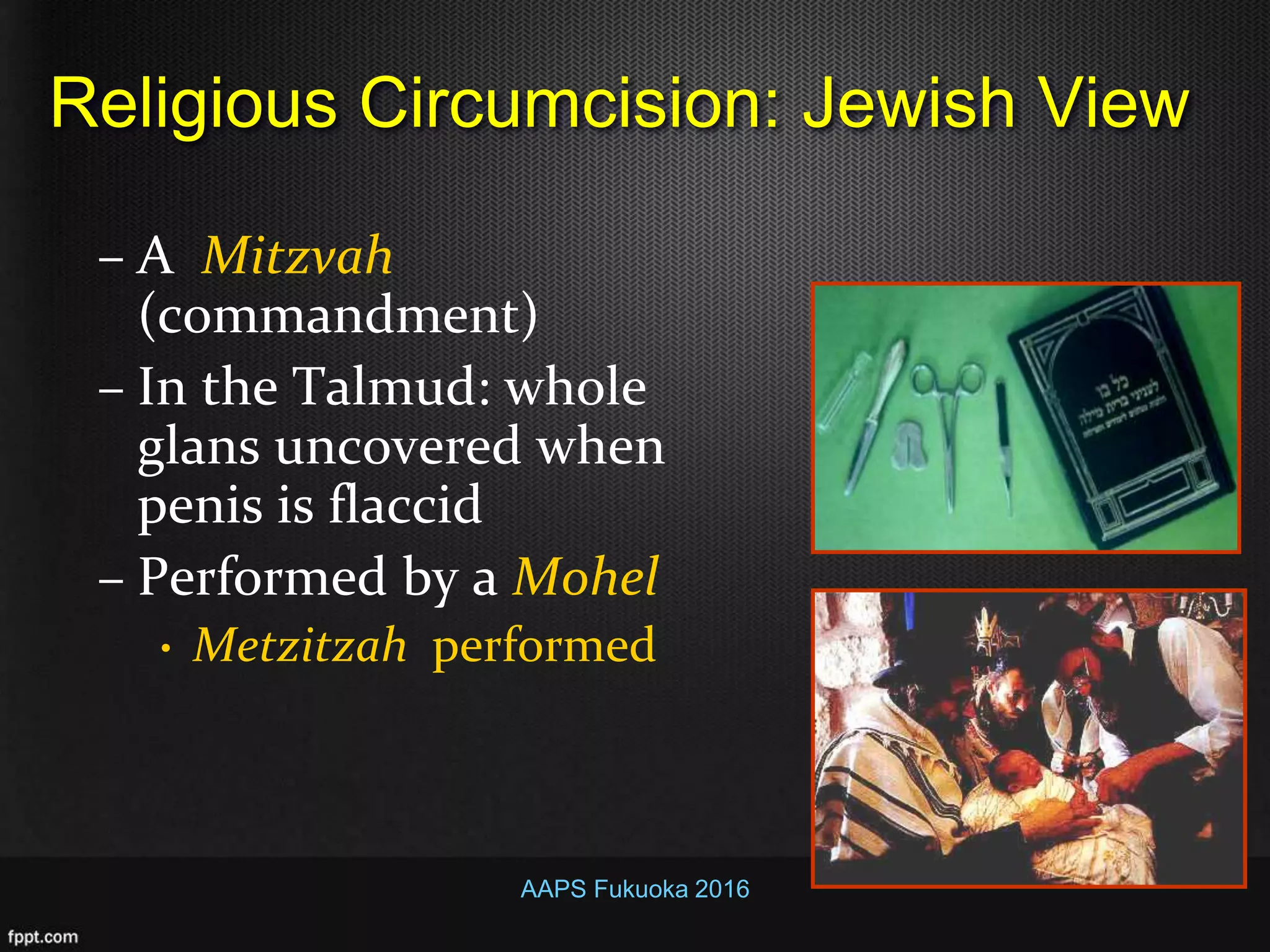 History of circumcision | PPT