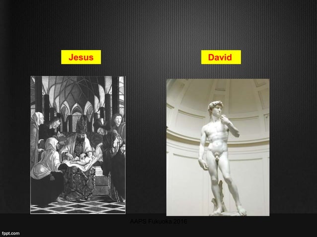 History of circumcision | PPT