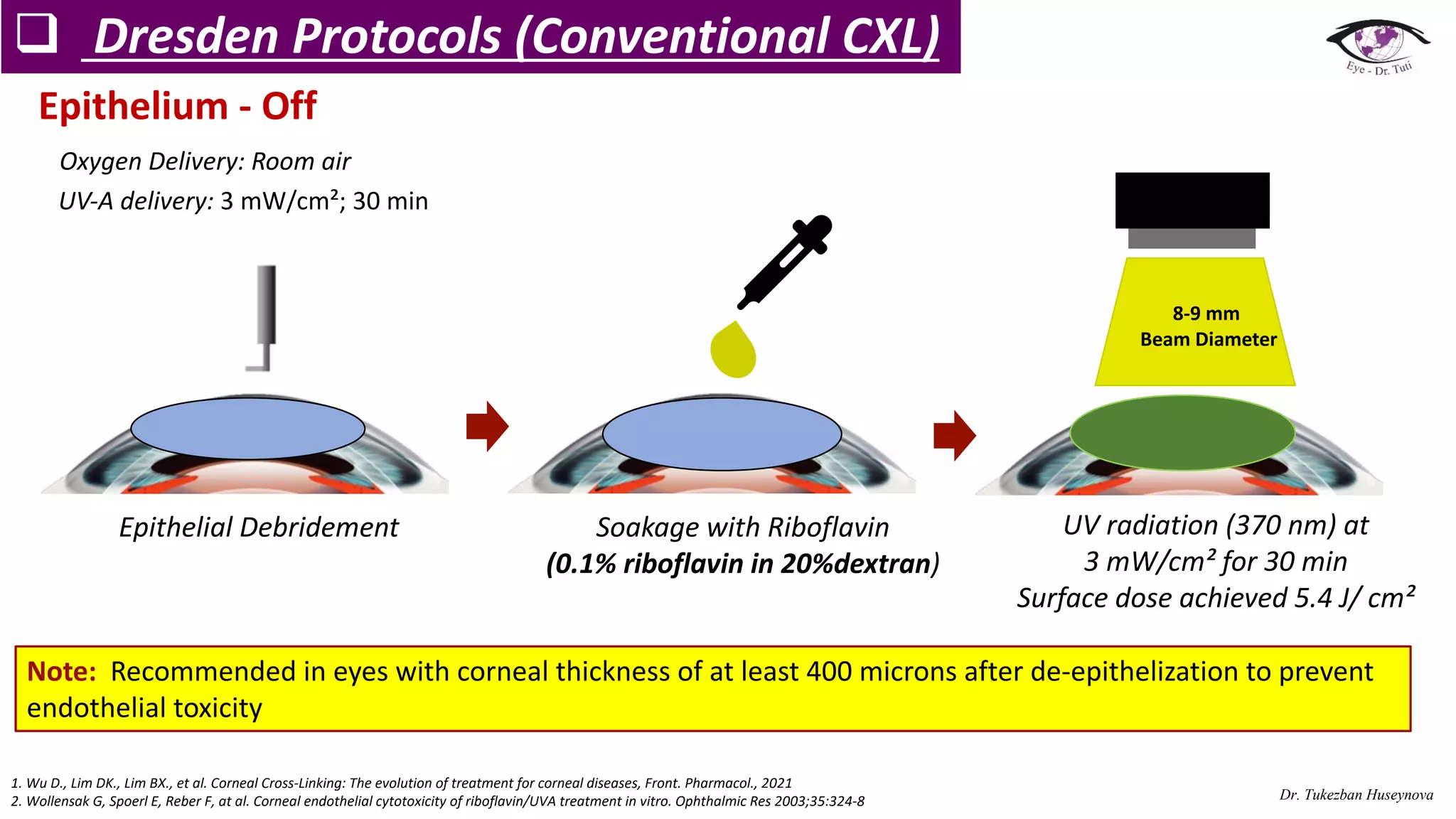 Corneal Cross Linking: Protocols and literature review | PDF