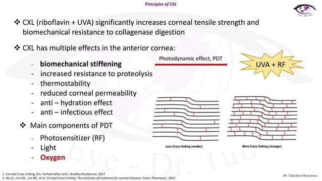 Corneal Cross Linking: Protocols and literature review | PDF | Eye and ...