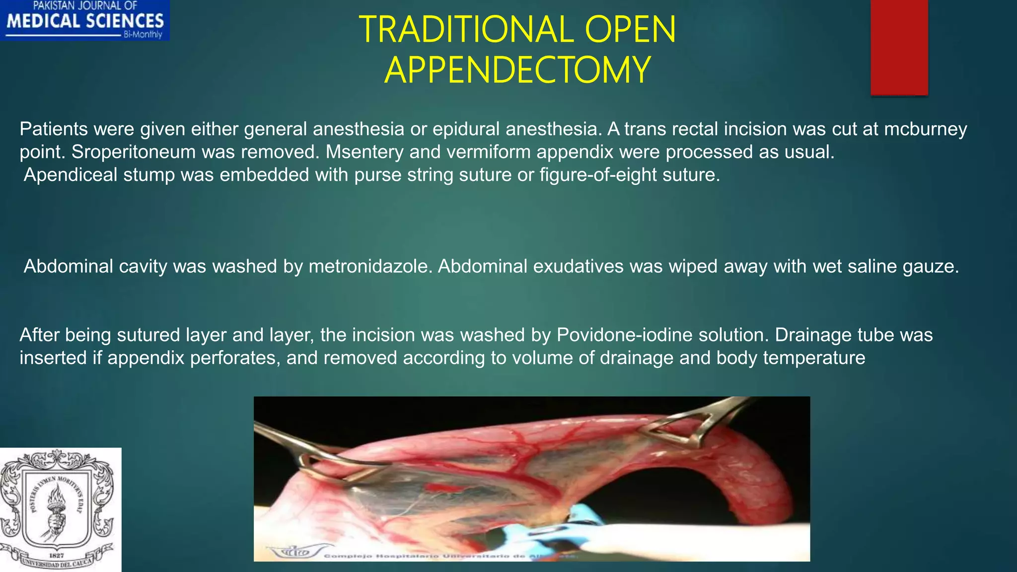 Comparison of Laparoscopic Appendectomy with open appendectomy in ...