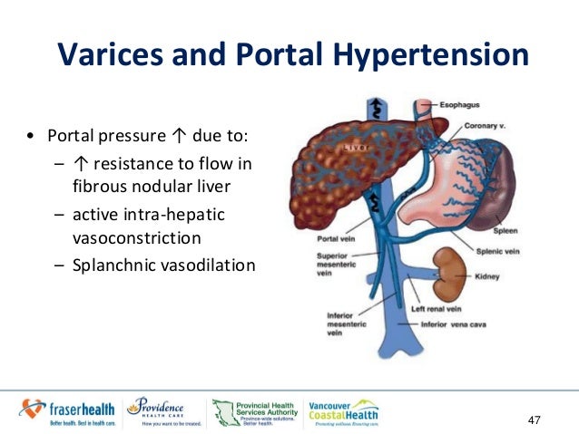 Complications of Liver Disease (Academic Day Seminar)