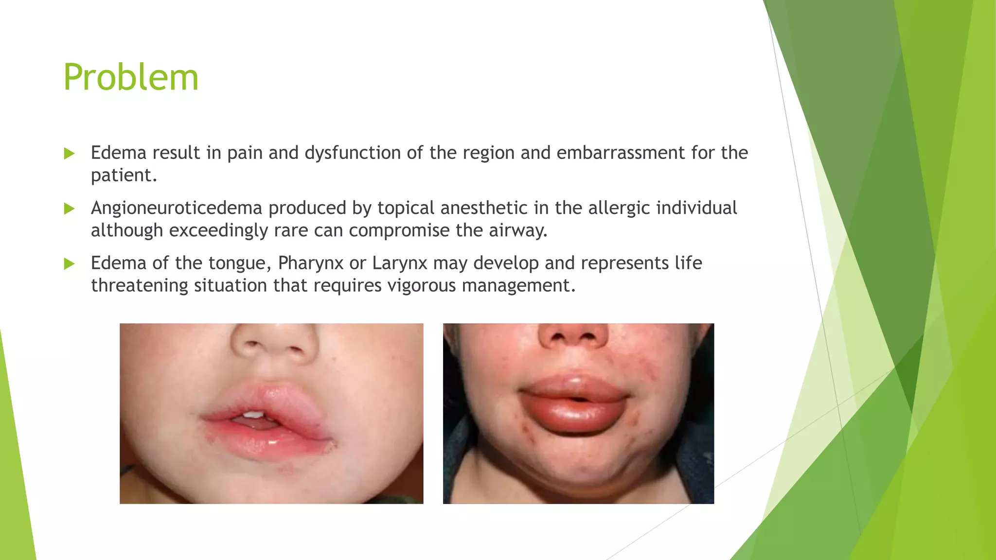 Complications of local anesthesia | PPTX