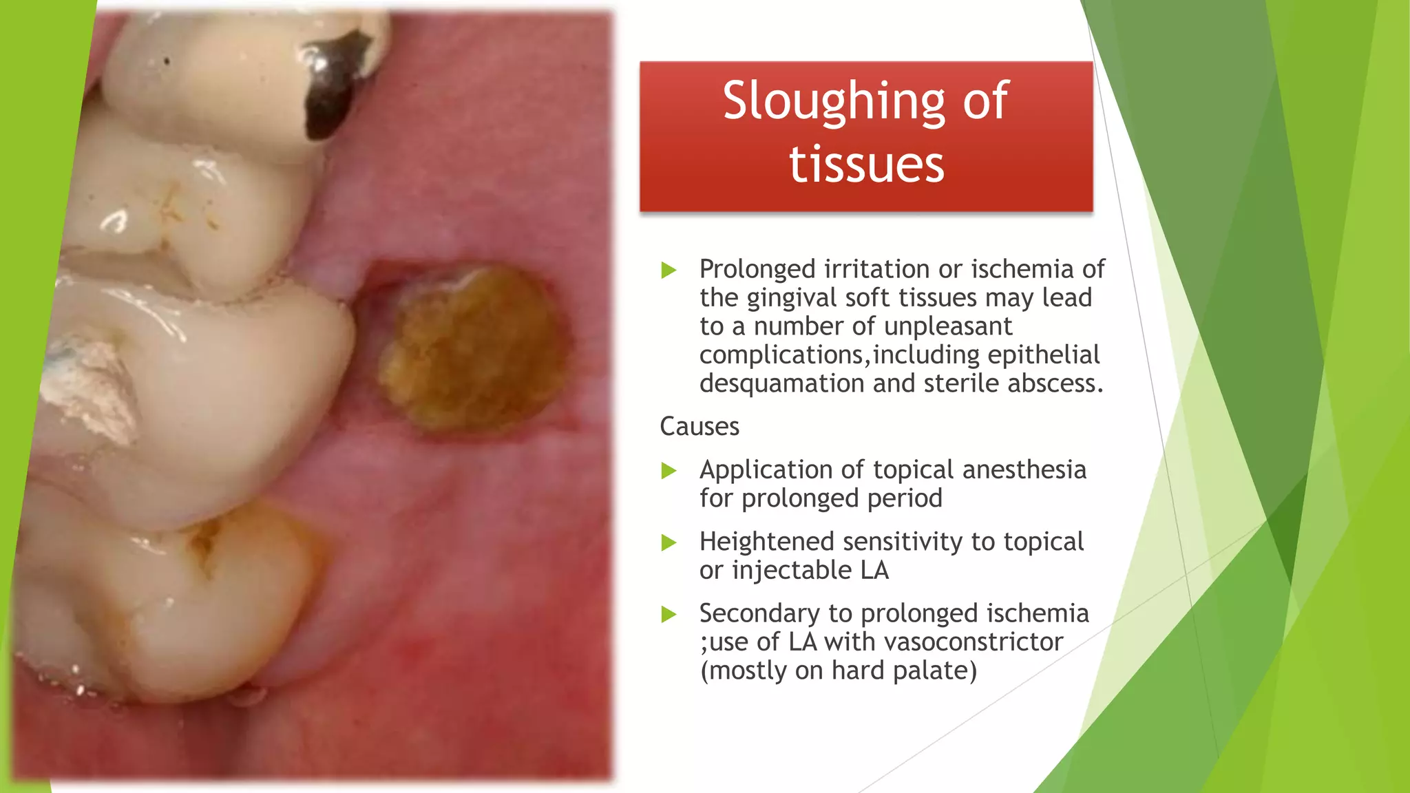 Complications of local anesthesia | PPTX