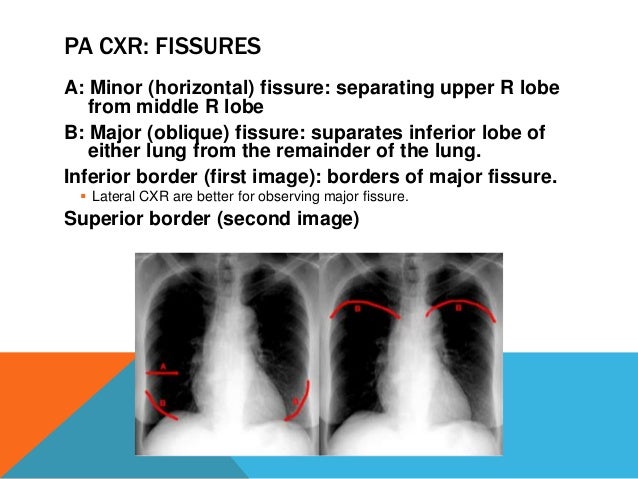 Pulmonology Radiology