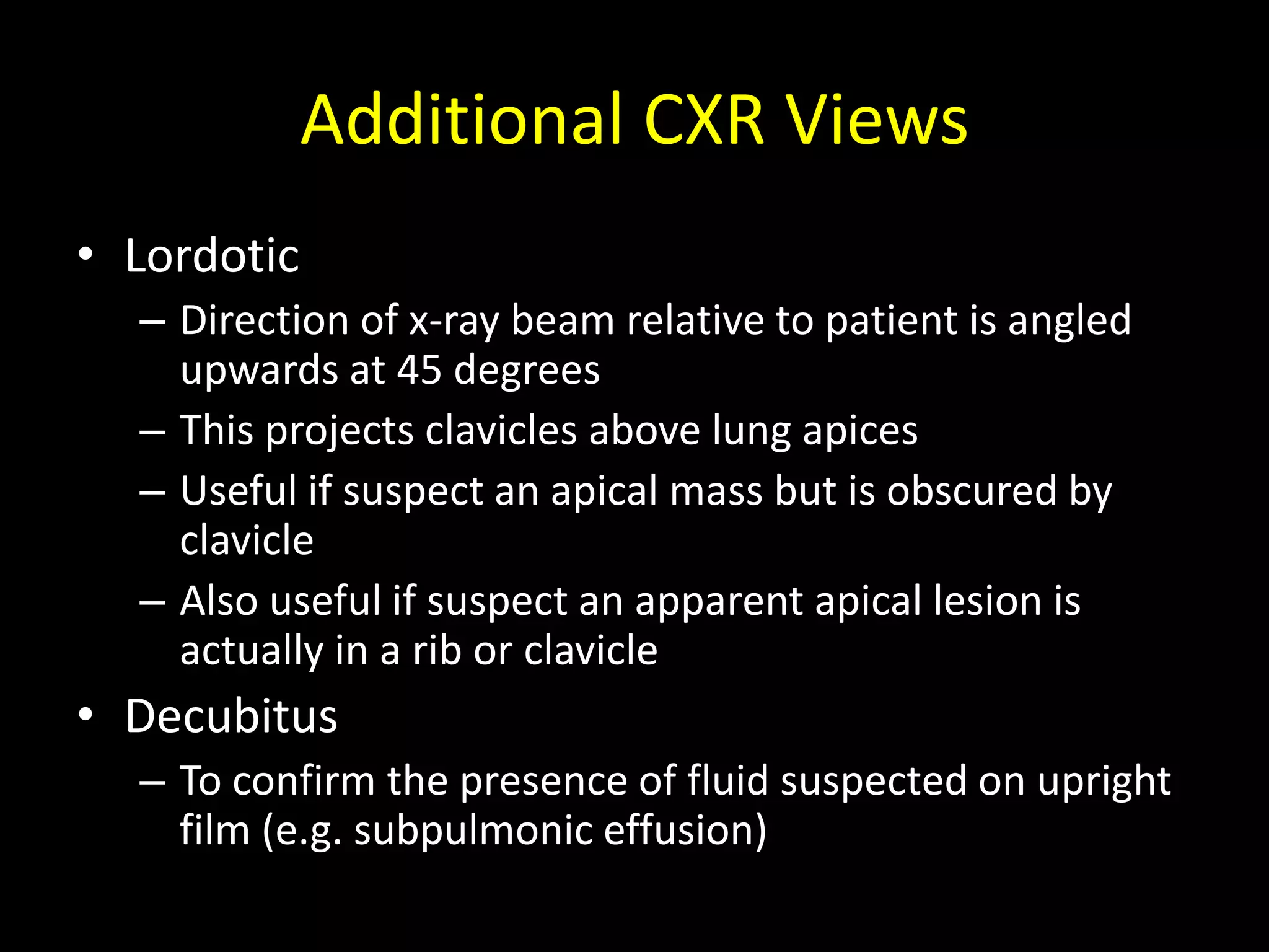 CXR Interpretation for Med Students | PPTX