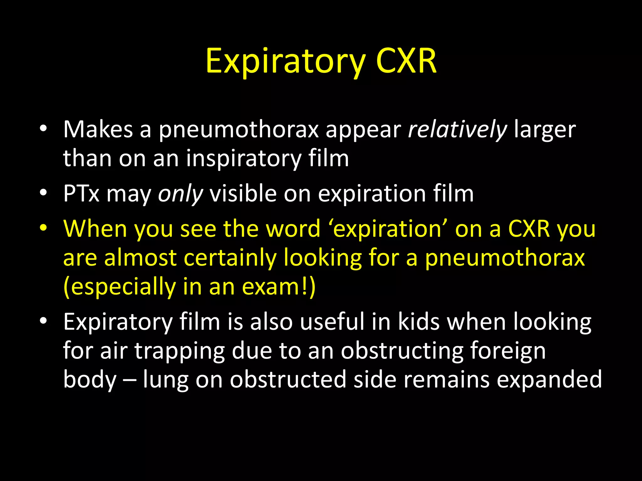 CXR Interpretation for Med Students | PPTX