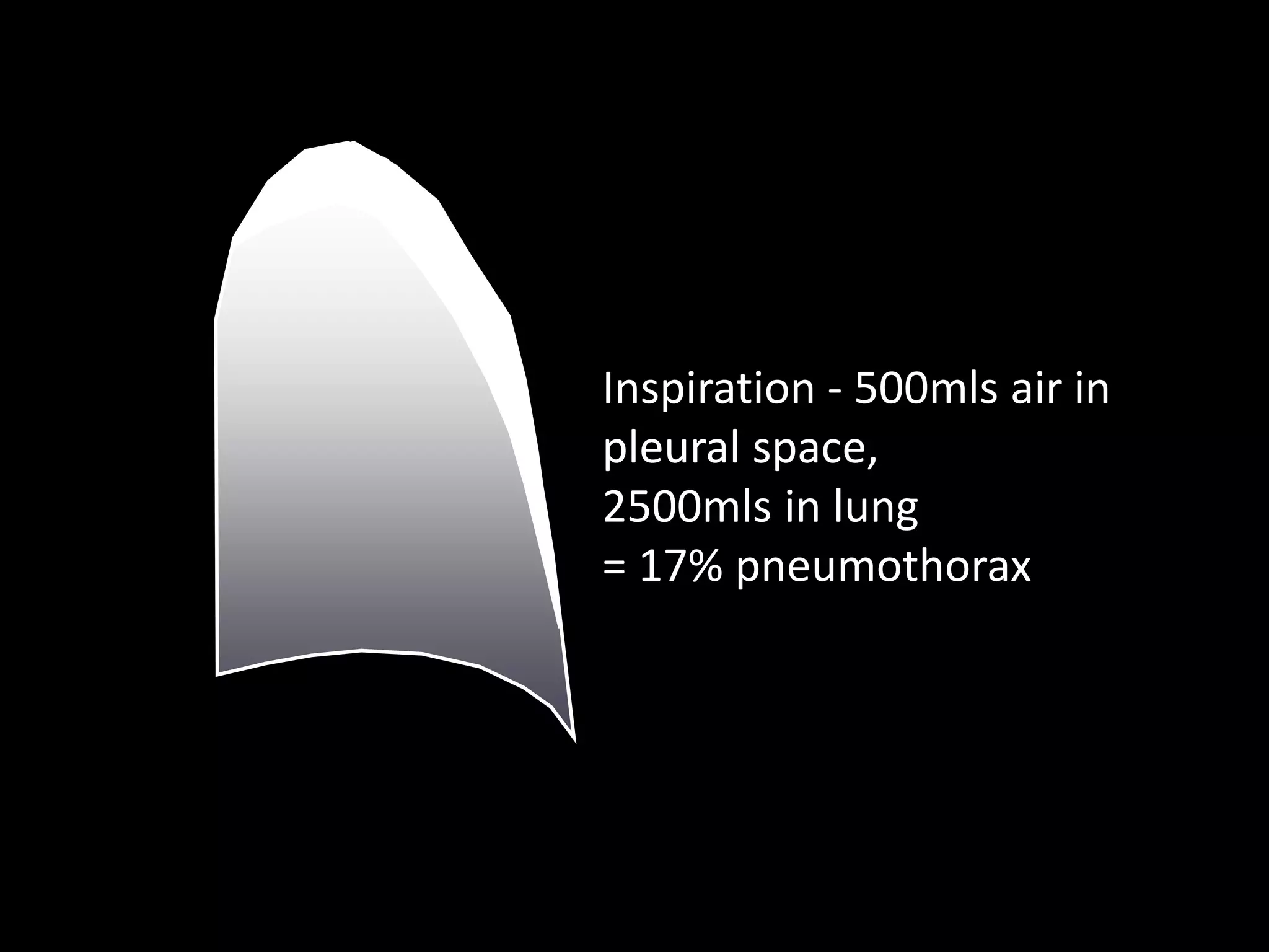 CXR Interpretation for Med Students | PPTX