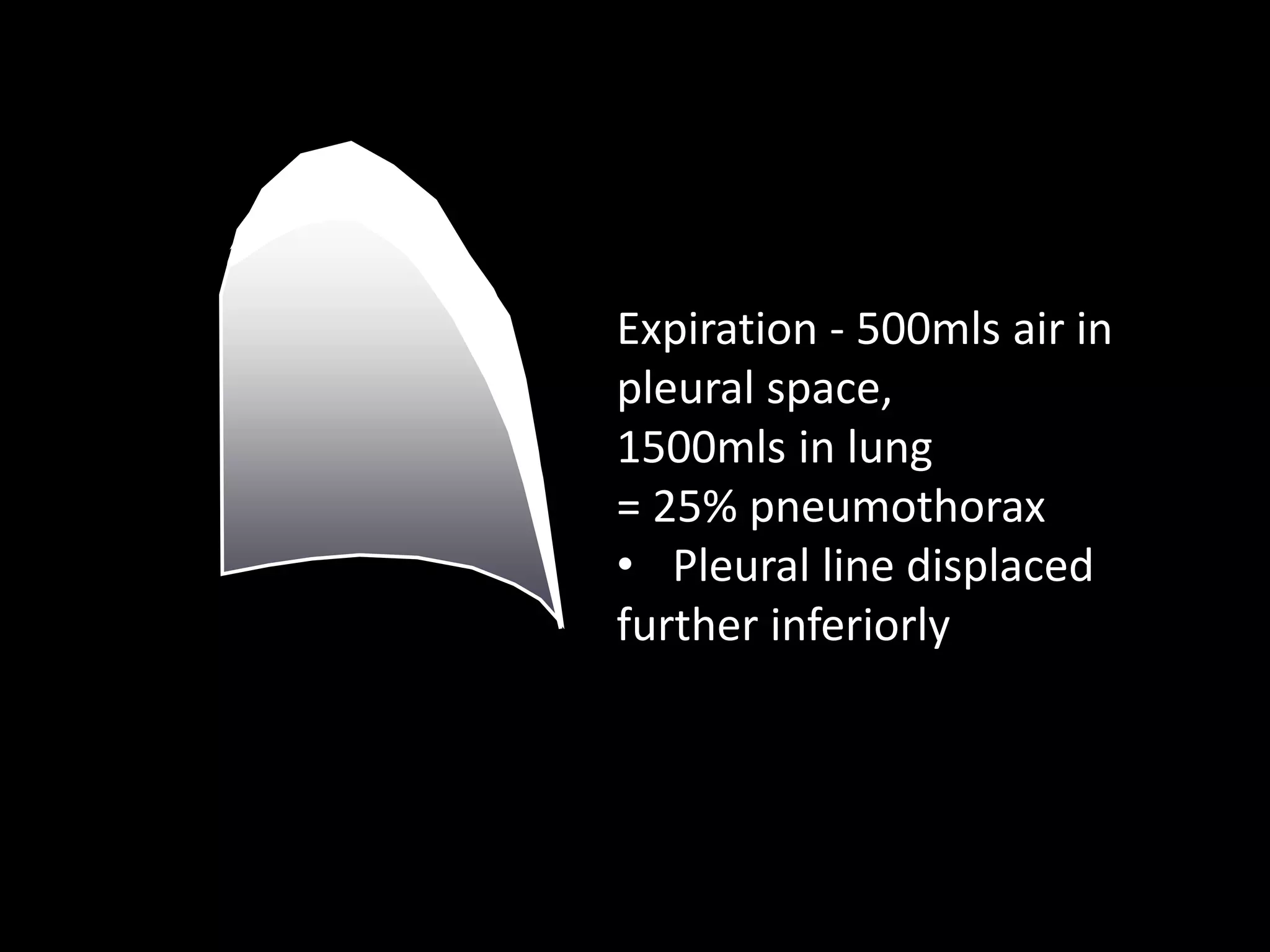 CXR Interpretation for Med Students | PPTX