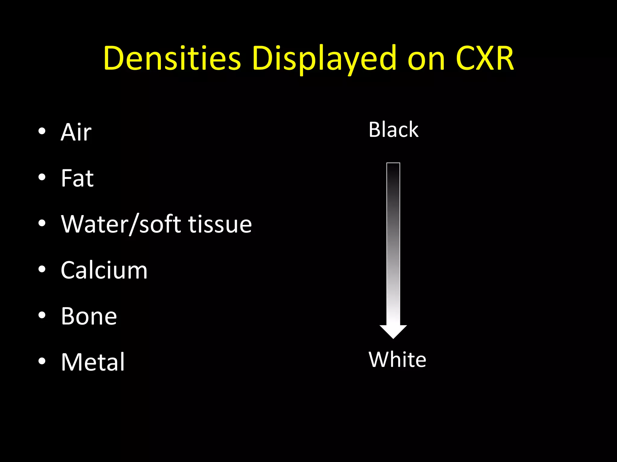 CXR Interpretation for Med Students | PPTX