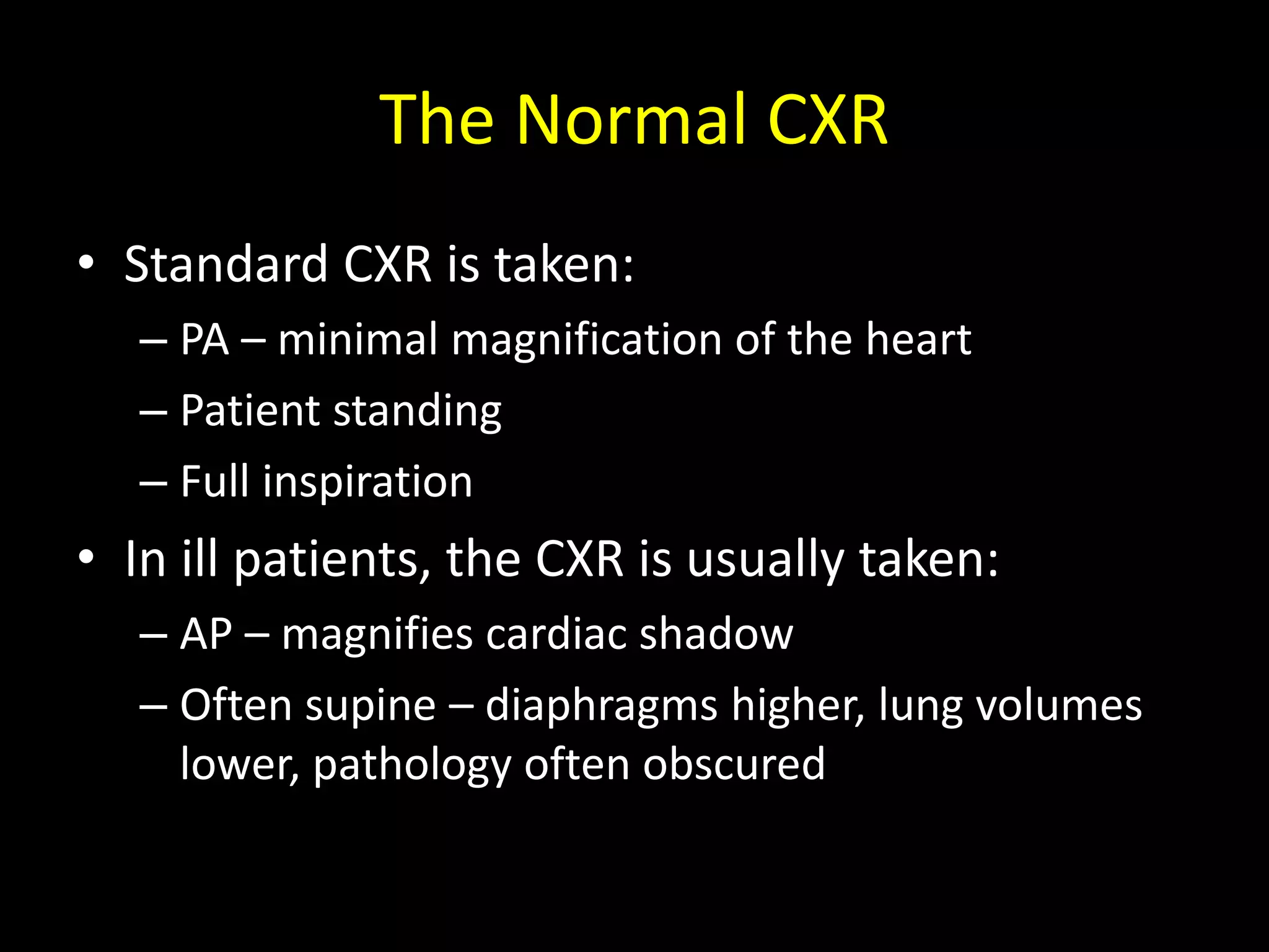 CXR Interpretation for Med Students | PPTX