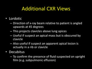 CXR Interpretation for Med Students | PPTX