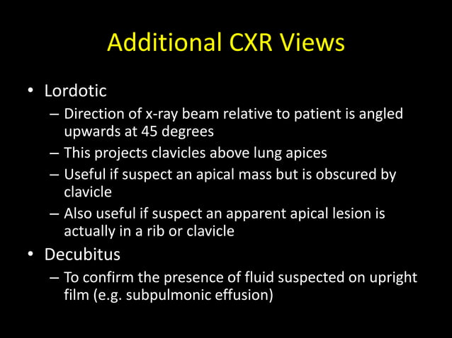 CXR Interpretation for Med Students | PPTX