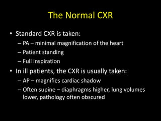 CXR Interpretation for Med Students | PPTX