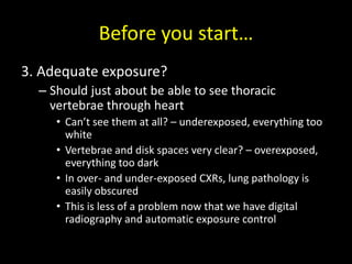 CXR Interpretation for Med Students | PPTX