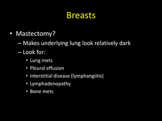 CXR Interpretation for Med Students | PPTX