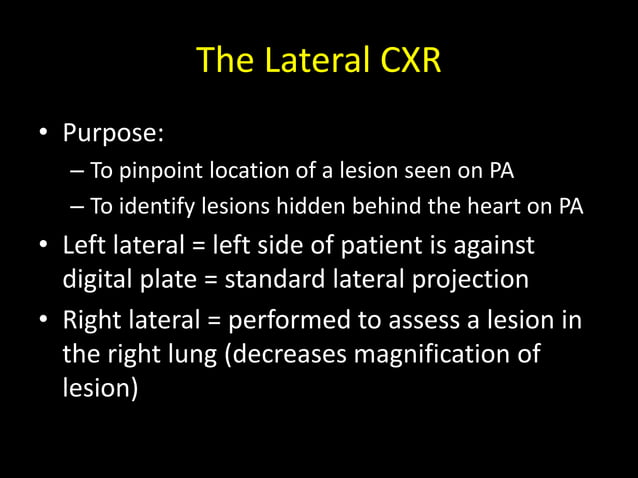 CXR Interpretation for Med Students | PPTX