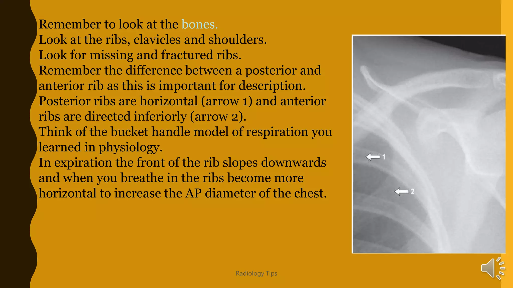 Chest X ray ( steps for interpretation) | PPTX