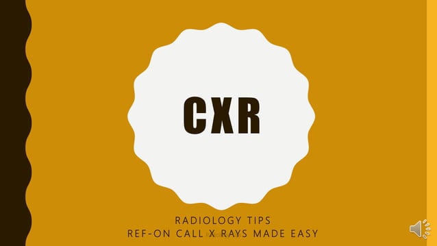 Chest X ray ( steps for interpretation) | PPTX | Lung and Respiratory ...