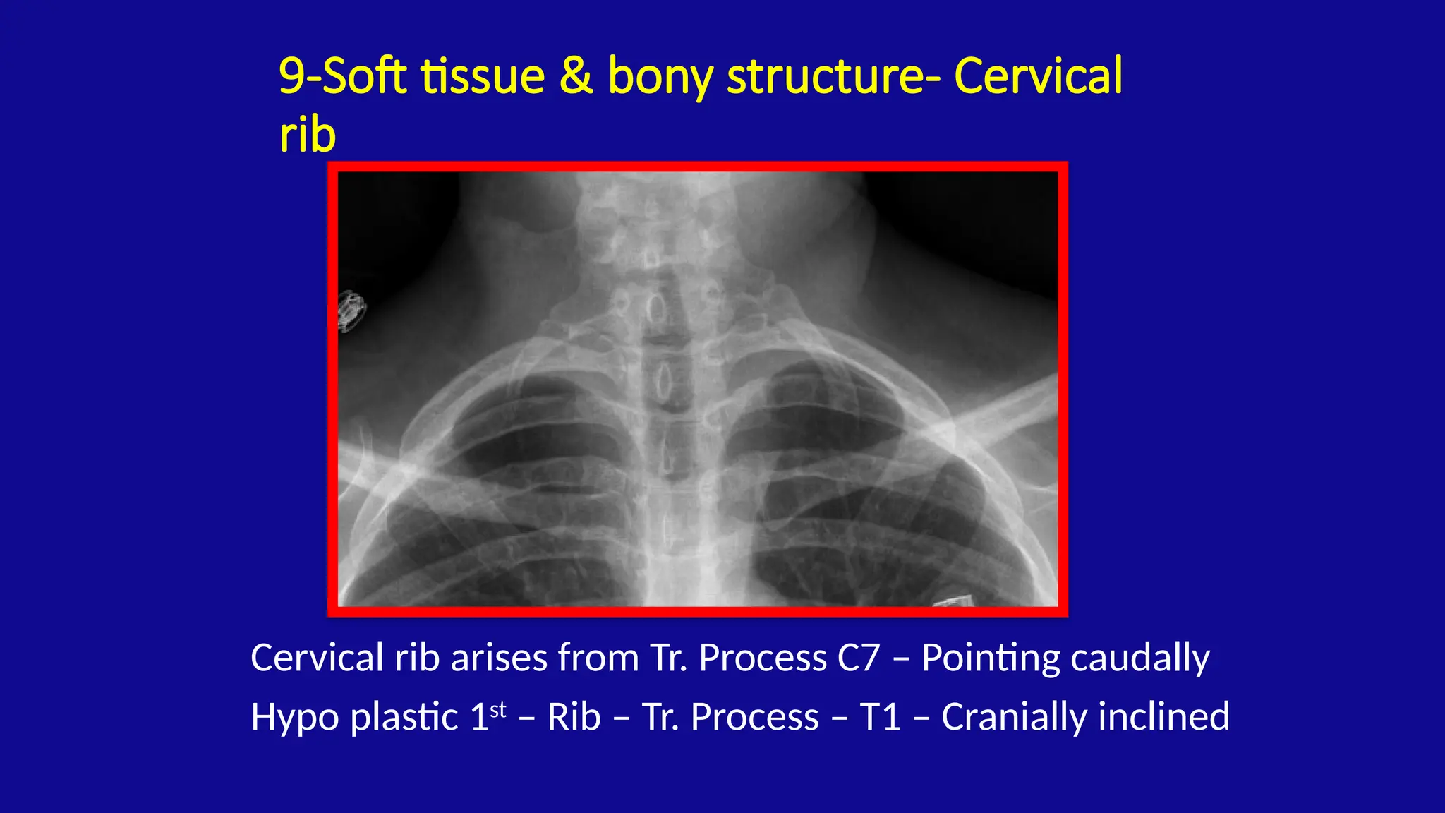 Chest xray - overview on mechanism of xray.pptx