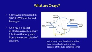 Chest xray - overview on mechanism of xray.pptx