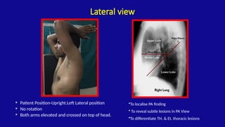 Chest xray - overview on mechanism of xray.pptx