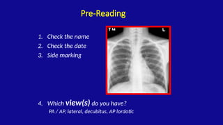 Chest xray - overview on mechanism of xray.pptx