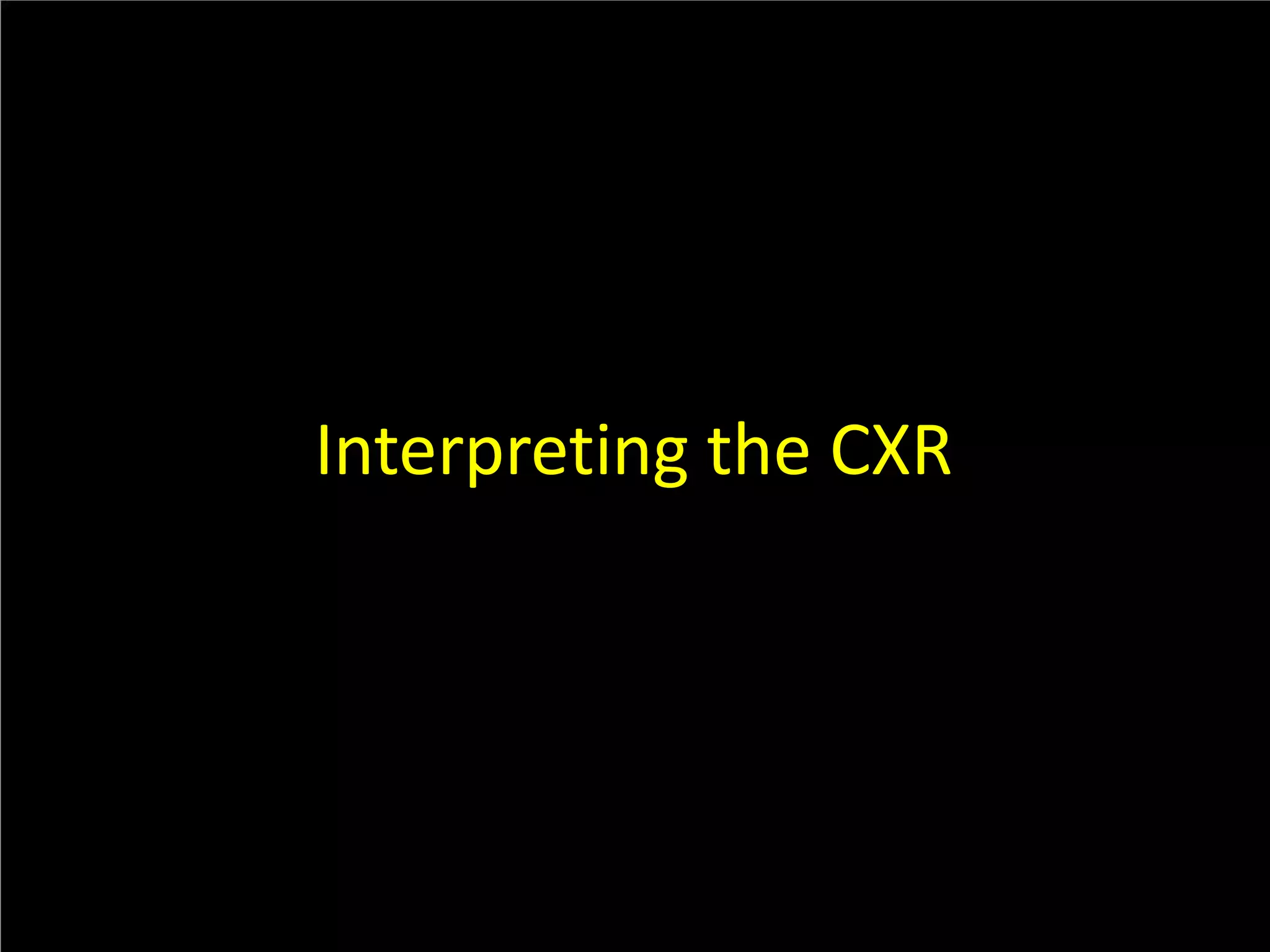 cxr-main.pptx