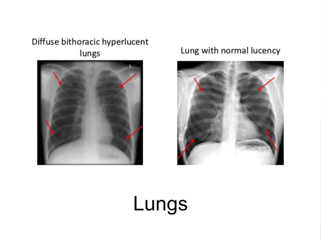 cxr-main.pptx