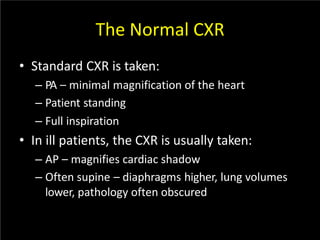 cxr-main.pptx
